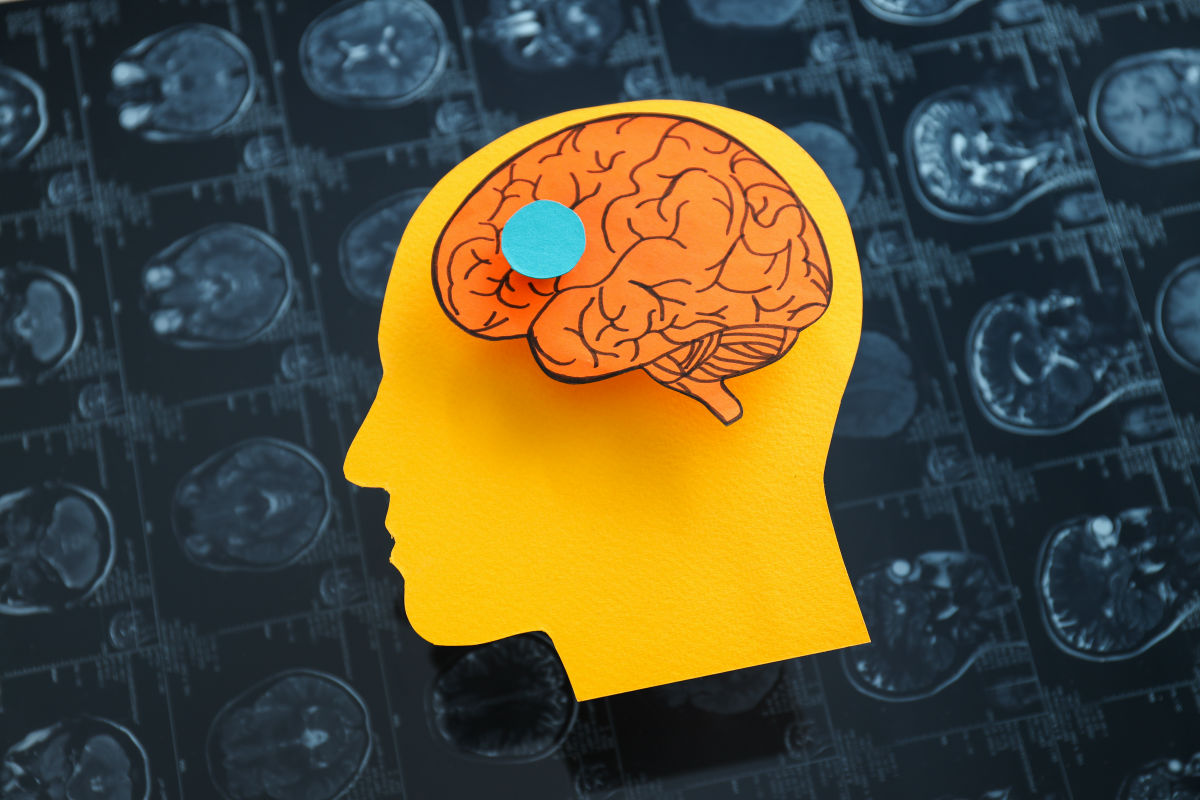 Research reveals that certain pesticides may increase Parkinson's ...